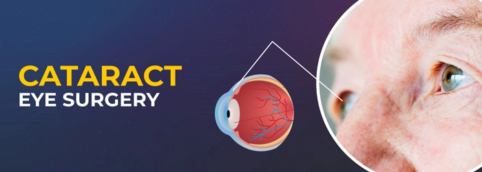 Understanding Cataracts and Modern Treatment Options